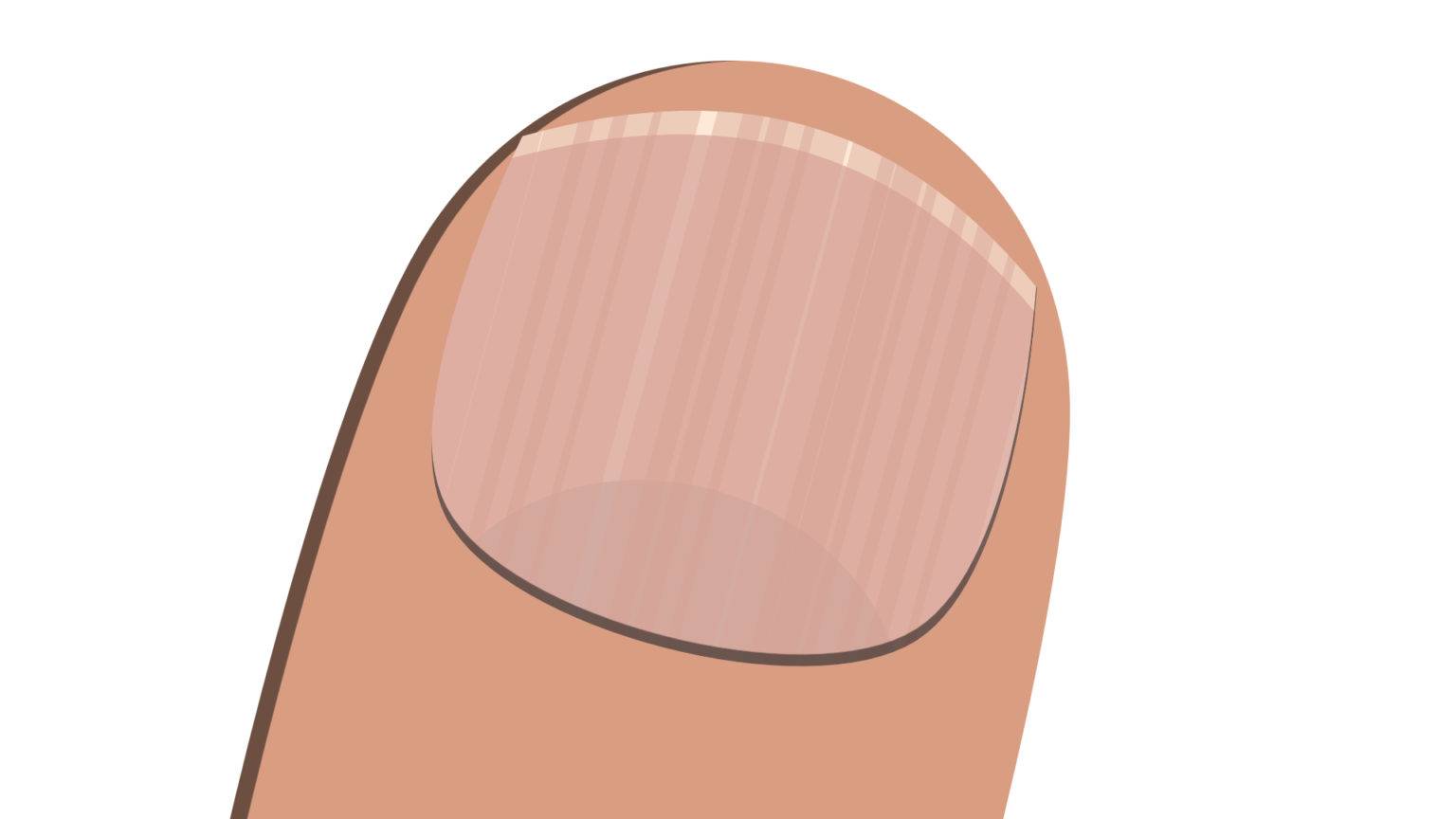 13 Common nail diseases and disorders – The Nail Tech Diaries